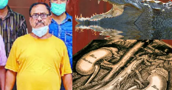 Doctor Death Devendra sharma | किडनी ट्रांसप्लांट कर मगरमच्छ को खिला ...